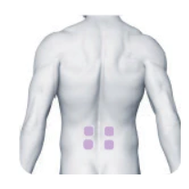 Get it right! The do’s and don'ts of placing TENS electrode pads. – Comfee